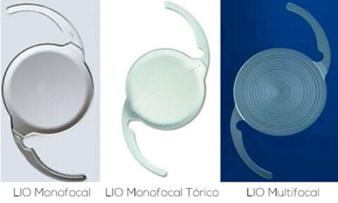 ¿Qué tipos de lentes intraoculares hay y cuál es el mejor para mí ...